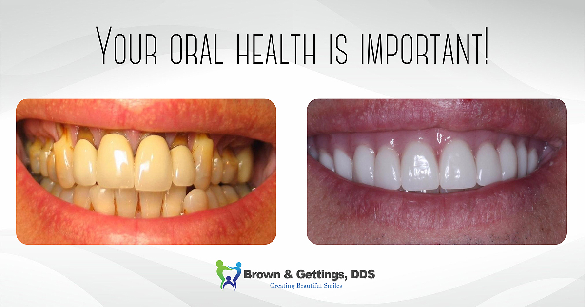 Your Oral Health Is Important! – Freedom Dental of West Chester