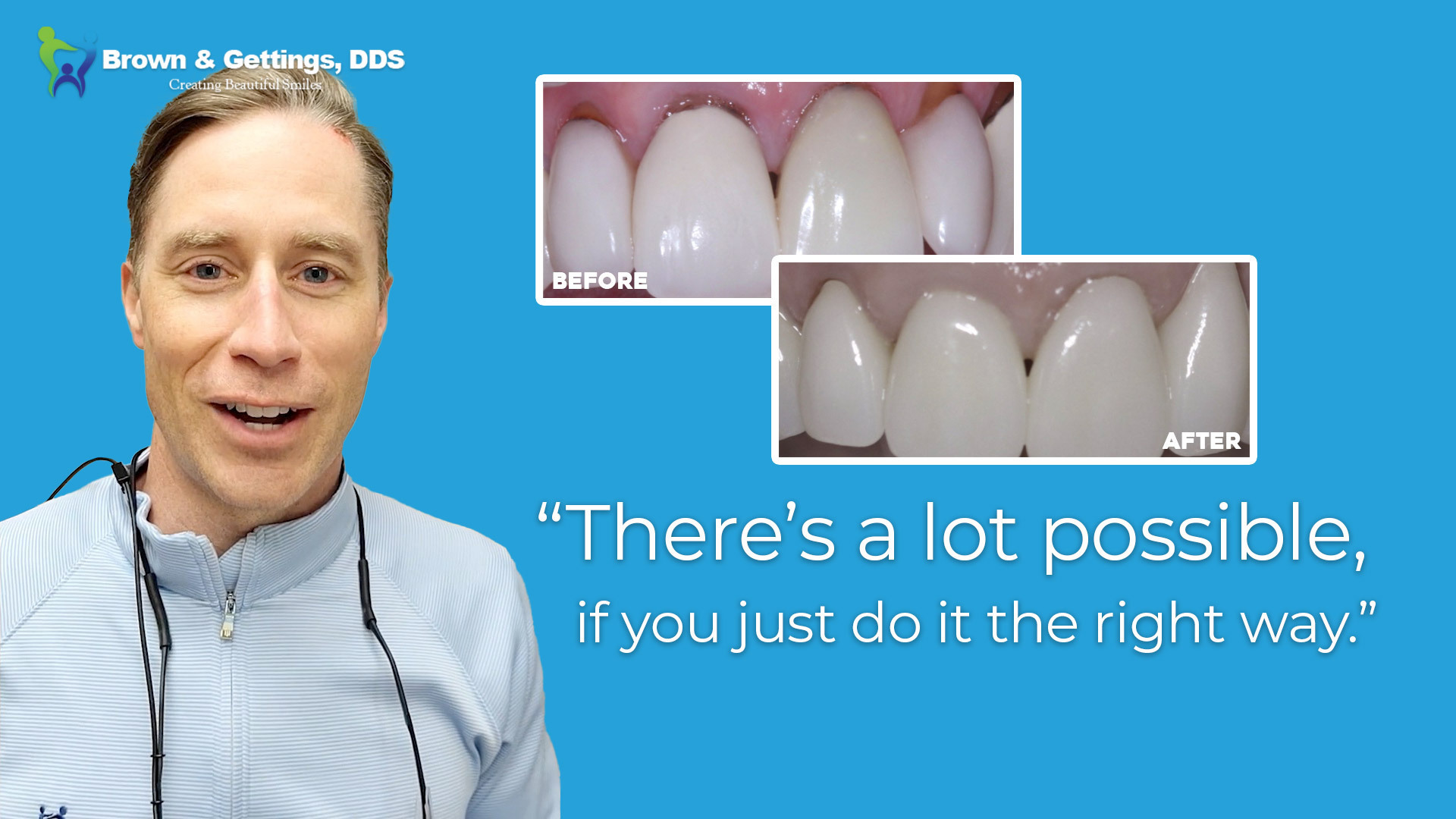 Smile Of The Week Story – Freedom Dental of West Chester