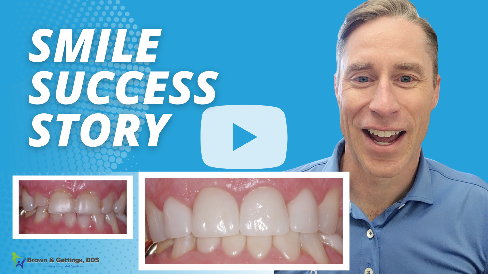 A Patient's Success Story