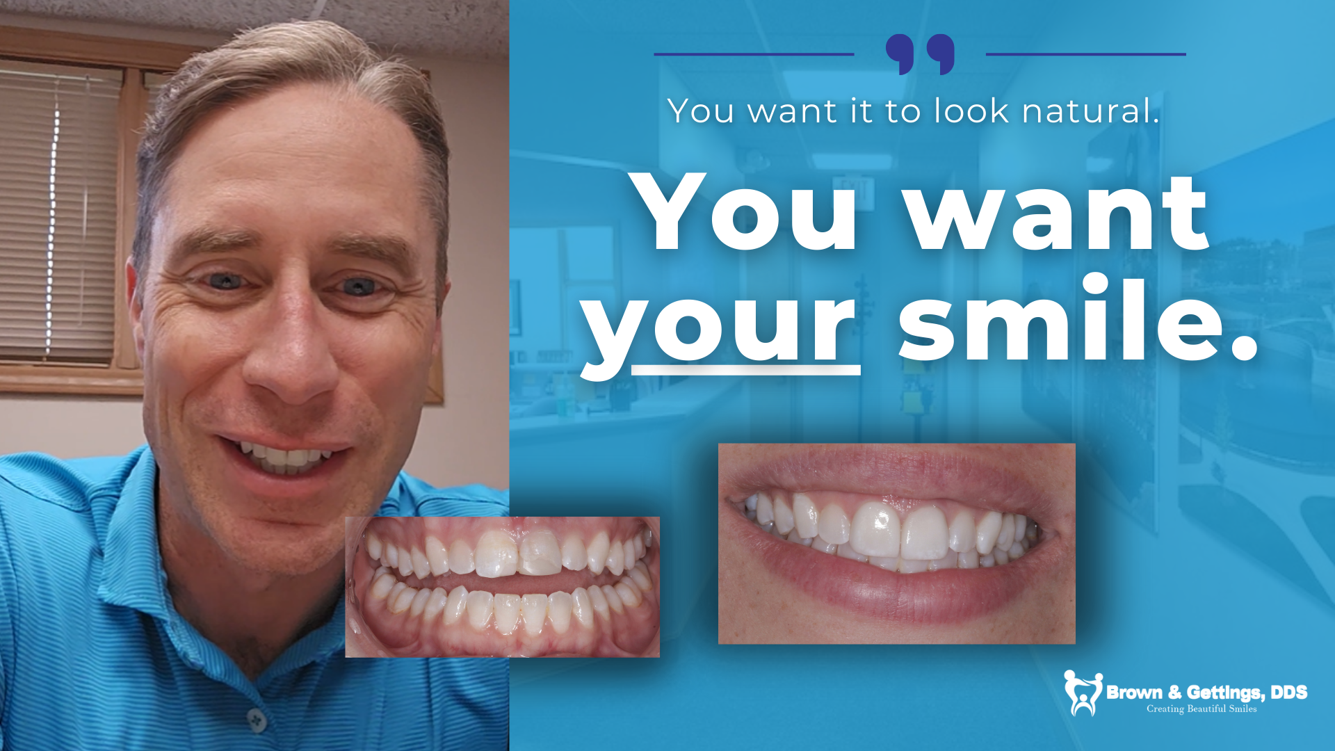 This is not a bad dream! – Drs. Brown, Gettings & Gade - West Chester, OH Dentists